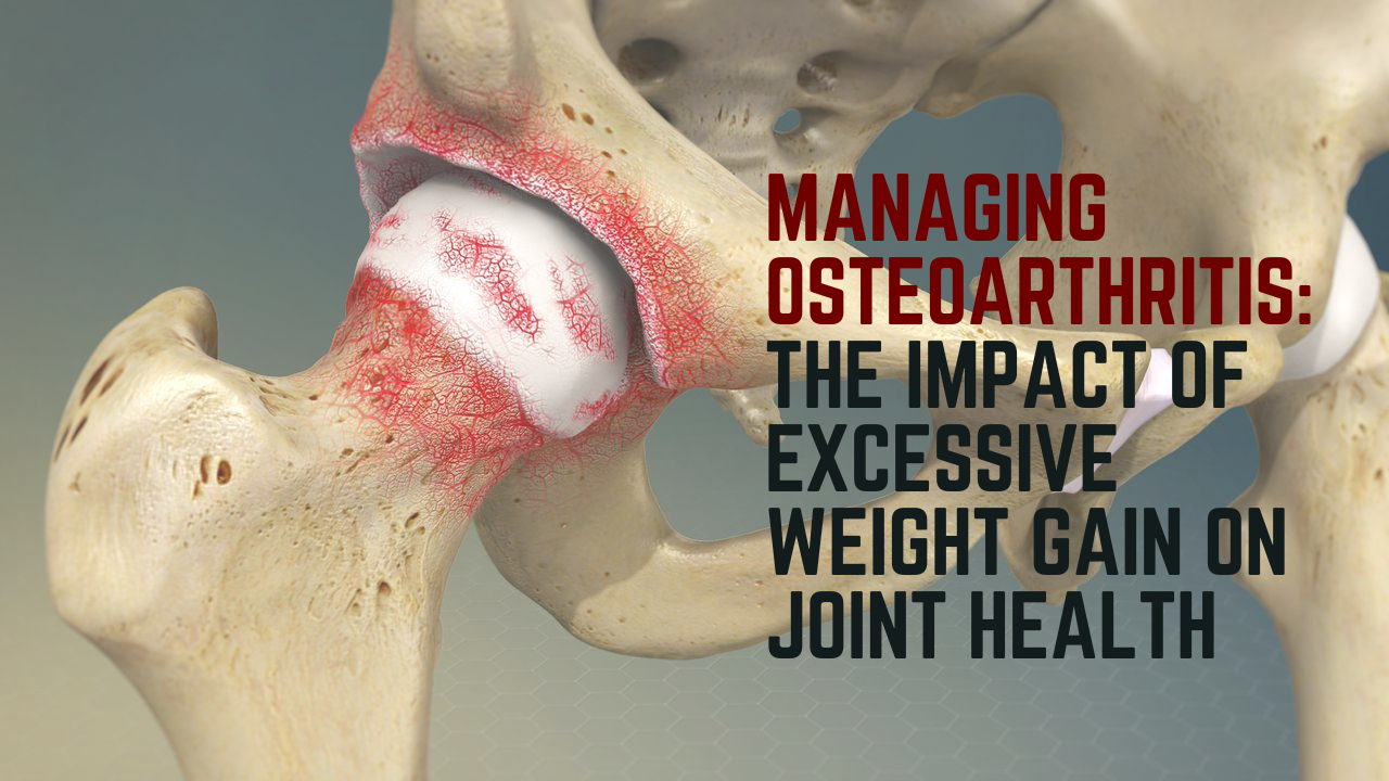 Managing Osteoarthritis: The Impact of Excessive Weight Gain on Joint ...